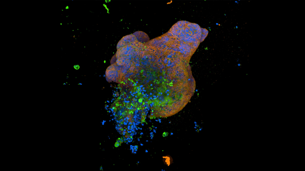 Cambridge University lab grown "mini guts" study – Crohn’s & Colitis ...